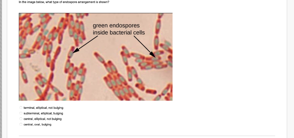 Solved When preparing a smear from a solid culture of a | Chegg.com