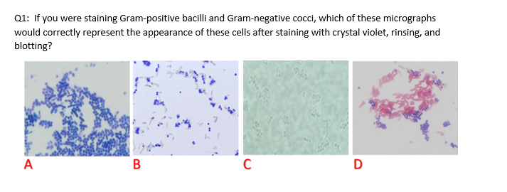 Solved Q4: How can gram staining be used effectively in the | Chegg.com