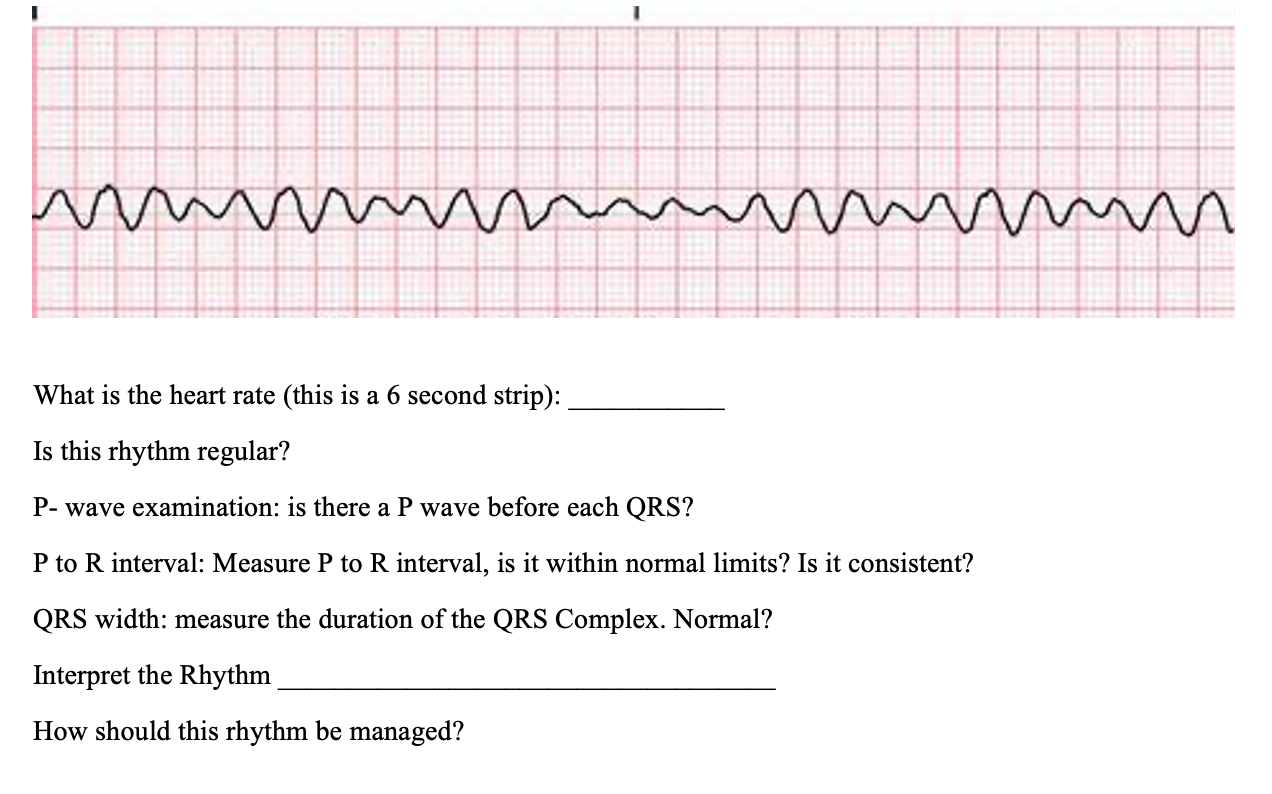 Solved IWhat is the heart rate (this is a 6 ﻿second | Chegg.com