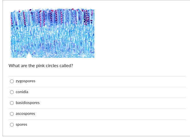 Solved What are the pink circles called? zygospores conidia | Chegg.com
