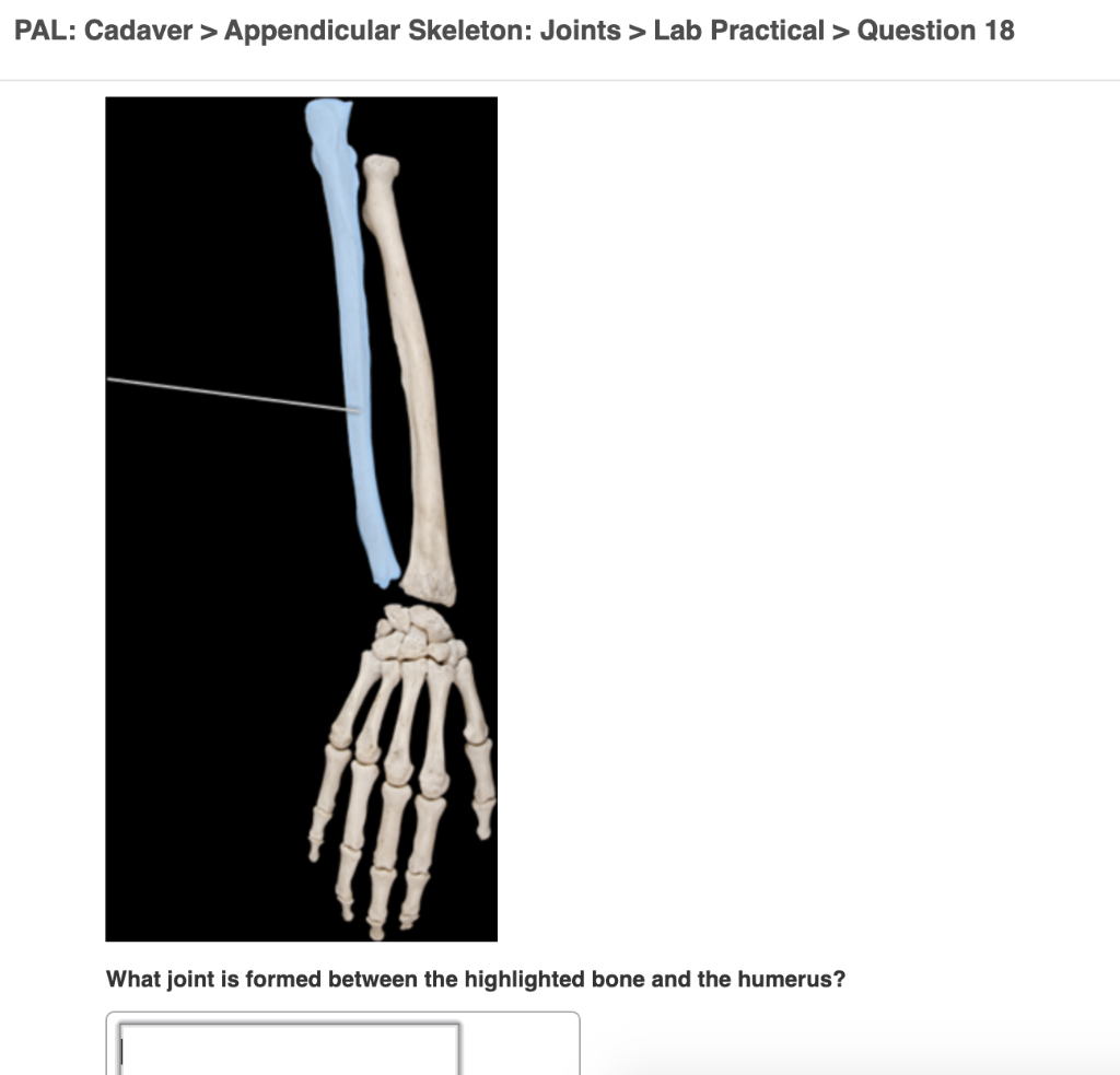 Solved PAL: Cadaver > Appendicular Skeleton: Joints > Lab | Chegg.com