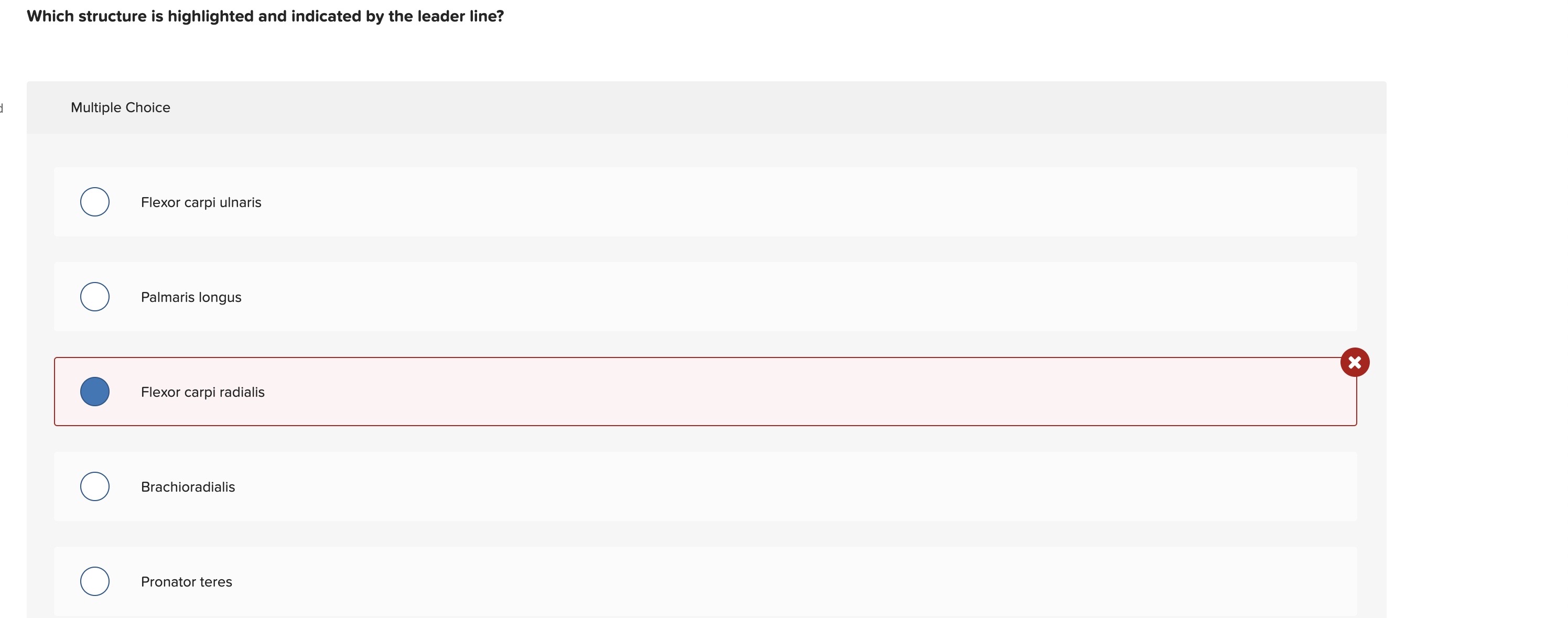 Which structure is highlighted? Multiple Choice | Chegg.com
