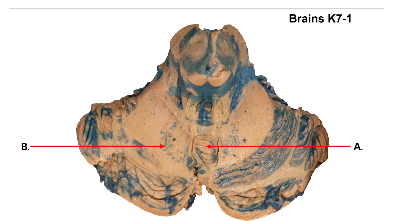 Solved Identify the structure labelled A and B. | Chegg.com