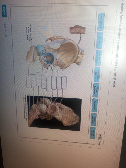 Solved Labeling Activity: Anatomical structure of the hip | Chegg.com