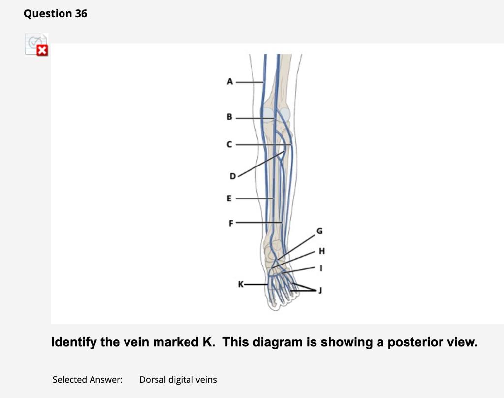 Solved Identify the vein marked K. This diagram is showing a | Chegg.com
