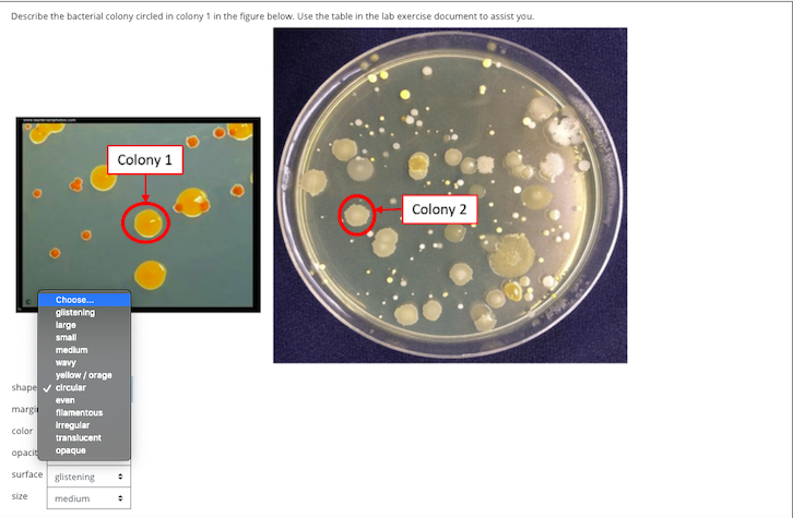 Solved Describe the bacterial colony circled in colony 1 in | Chegg.com
