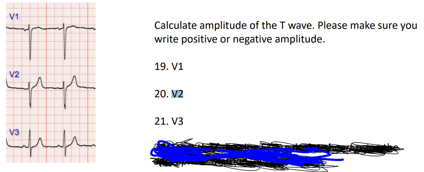 Solved V1 Calculate amplitude of the T wave. Please make | Chegg.com