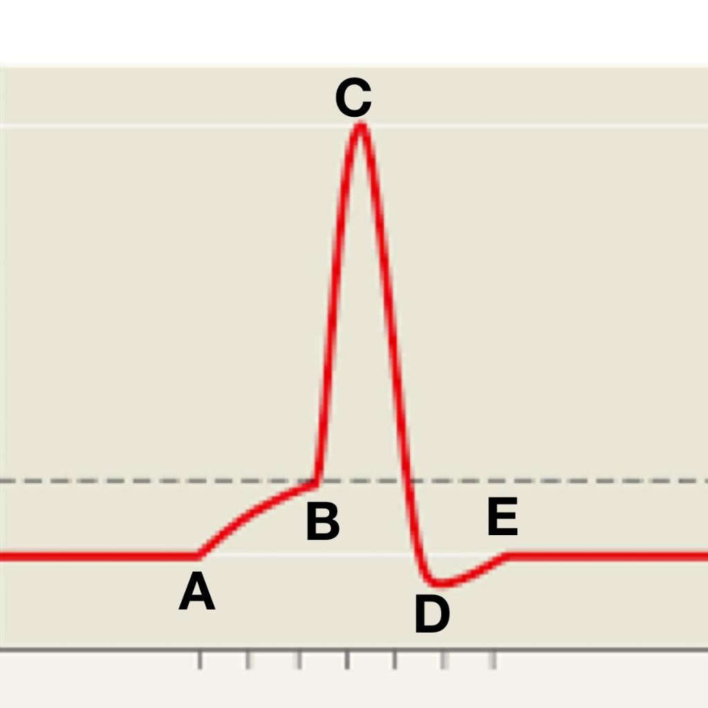 Solved The above graph represents muscular | Chegg.com