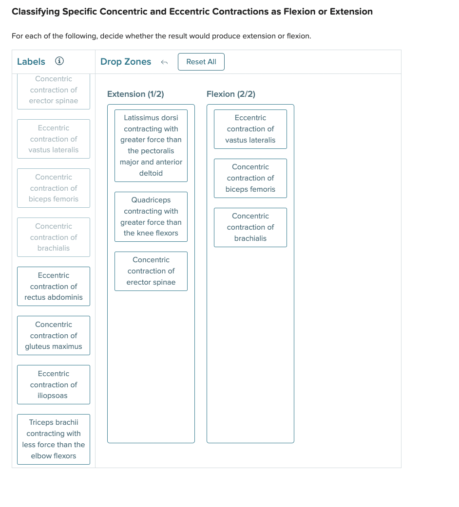 Solved Classifying Specific Concentric and Eccentric | Chegg.com