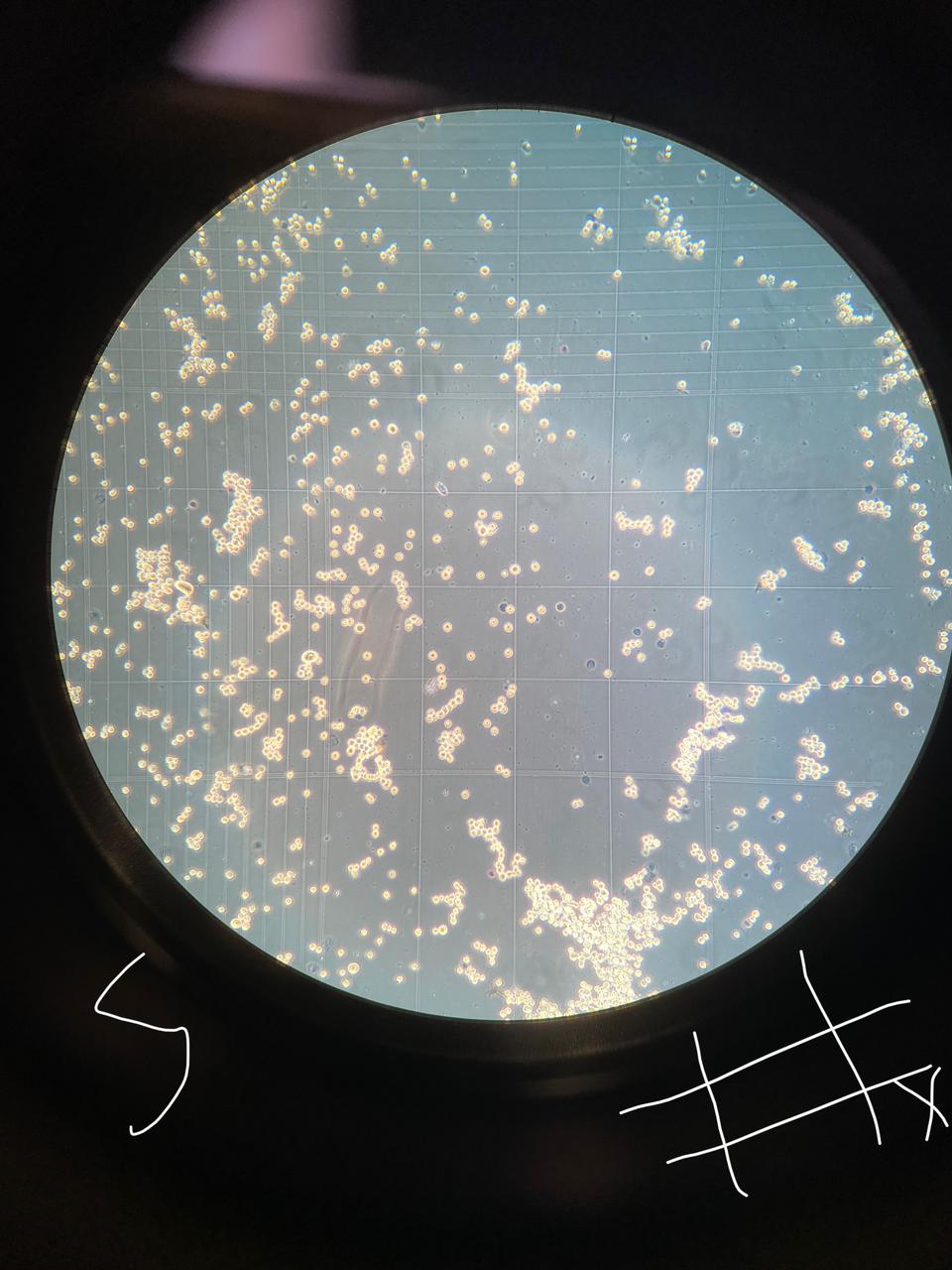 Solved Counting trypsinized cells (with 5% & 10% ethanol) on | Chegg.com