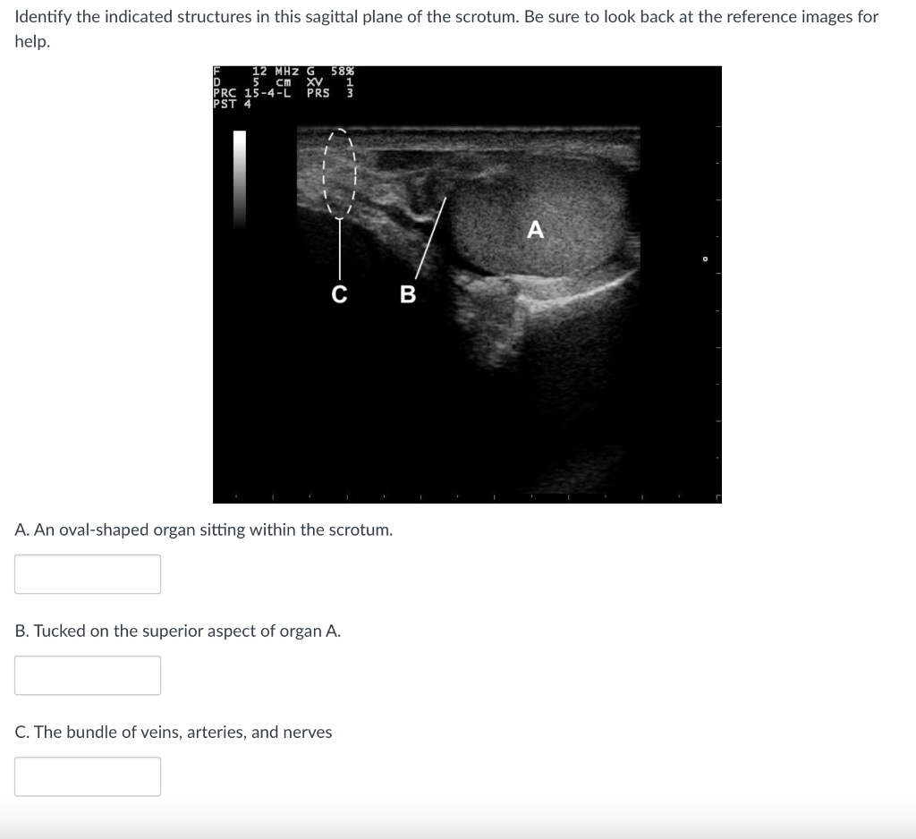 Solved Identify the indicated structures in this sagittal | Chegg.com