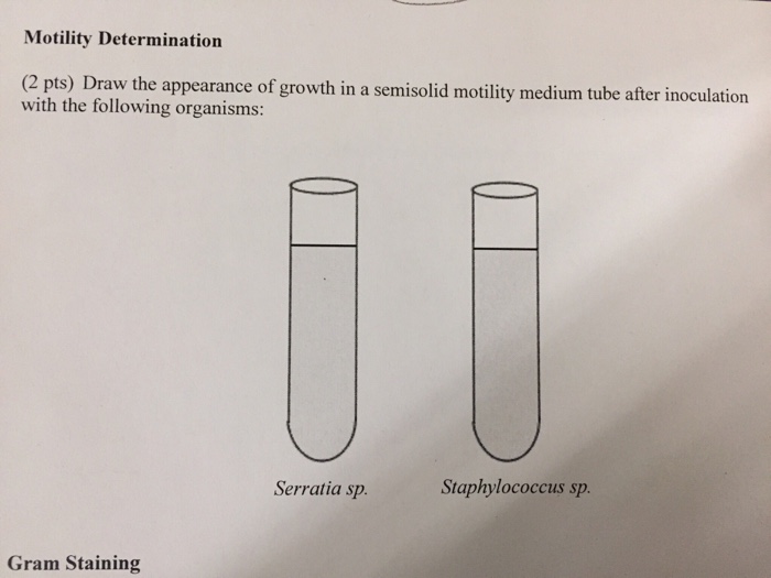 Solved Motility Determination (2 pts) Draw the appearance of | Chegg.com