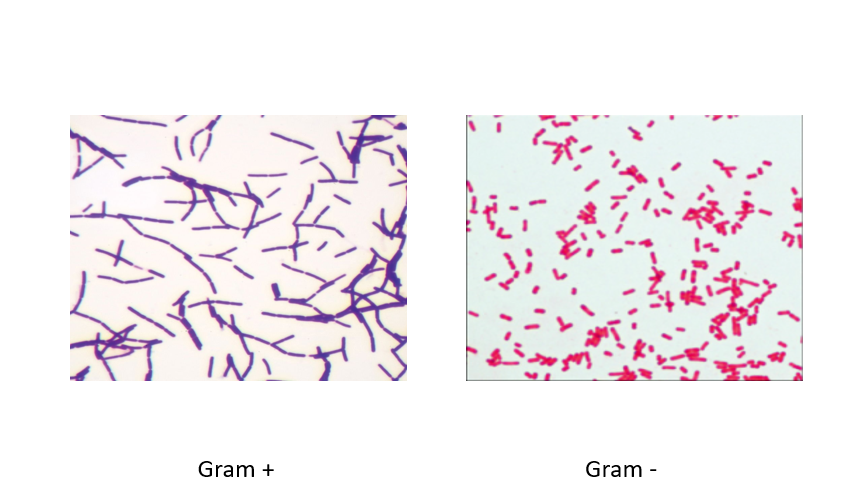 Solved Recommended Flowchart to identify Gram-Negative and | Chegg.com
