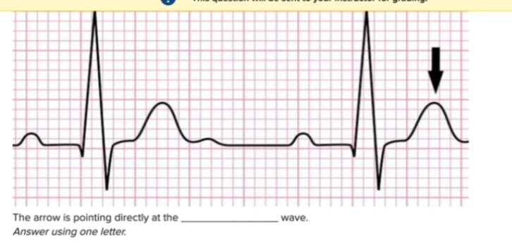 Solved المہ wave. The arrow is pointing directly at the | Chegg.com