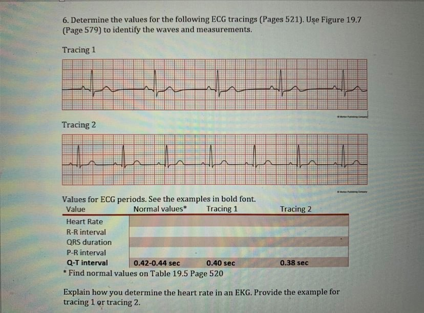 Solved 6. Determine the values for the following ECG | Chegg.com