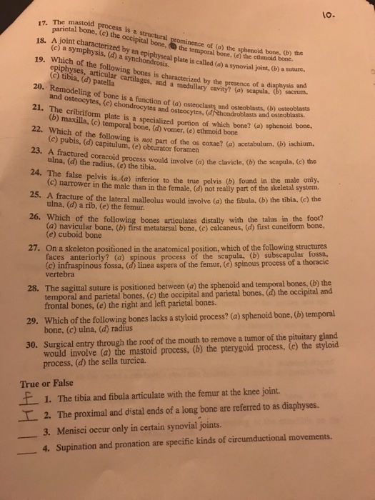 Solved Io. parietal mastoid process is a structural A joint | Chegg.com