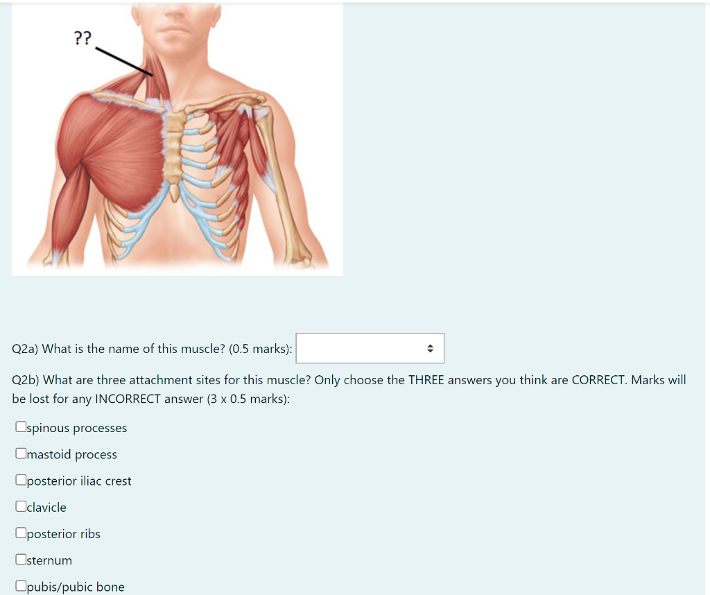 Solved Q2a) What is the name of this muscle? (0.5 marks): | Chegg.com