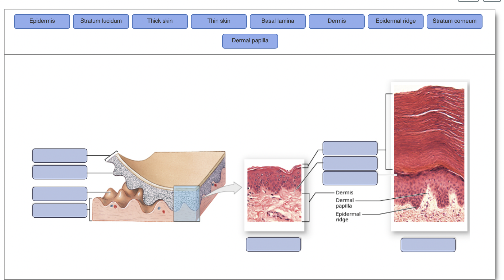 Solved Epidermis Stratum lucidum Thick skin Thin skin Basal | Chegg.com