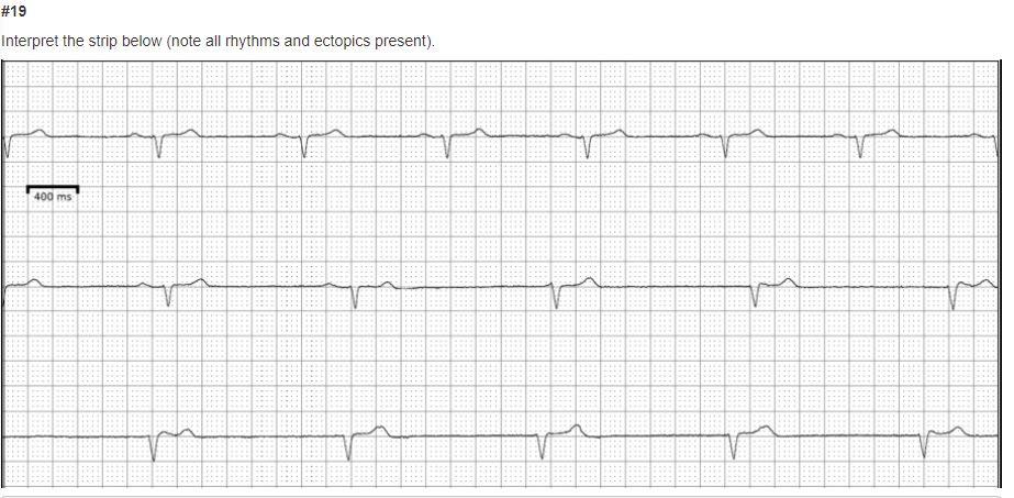 Solved Interpret the strip below (note all rhythms and | Chegg.com