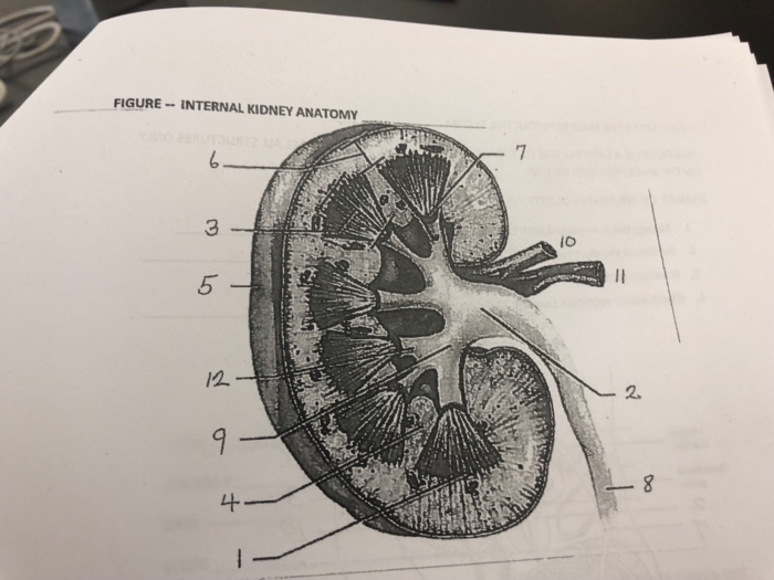 Solved FIGURE-INTERNAL KIDNEY ANATOMY 3 5 12 2. ? | Chegg.com