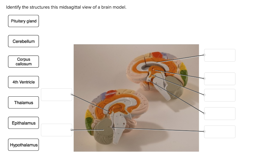 Solved Identify the structures on this anterior-lateral view | Chegg.com