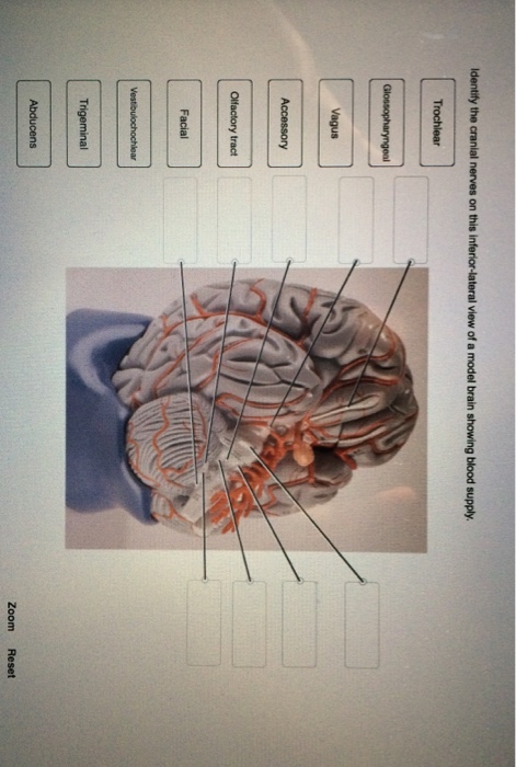 Solved Identify the cranial nerves on this inferior-lateral | Chegg.com