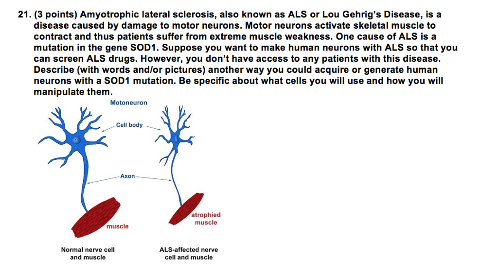 Solved 21. (3 points) Amyotrophic lateral sclerosis, also | Chegg.com