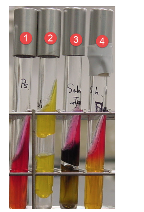 Triple Sugar Iron Agar