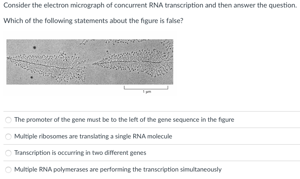 Solved Consider the electron micrograph of concurrent RNA | Chegg.com