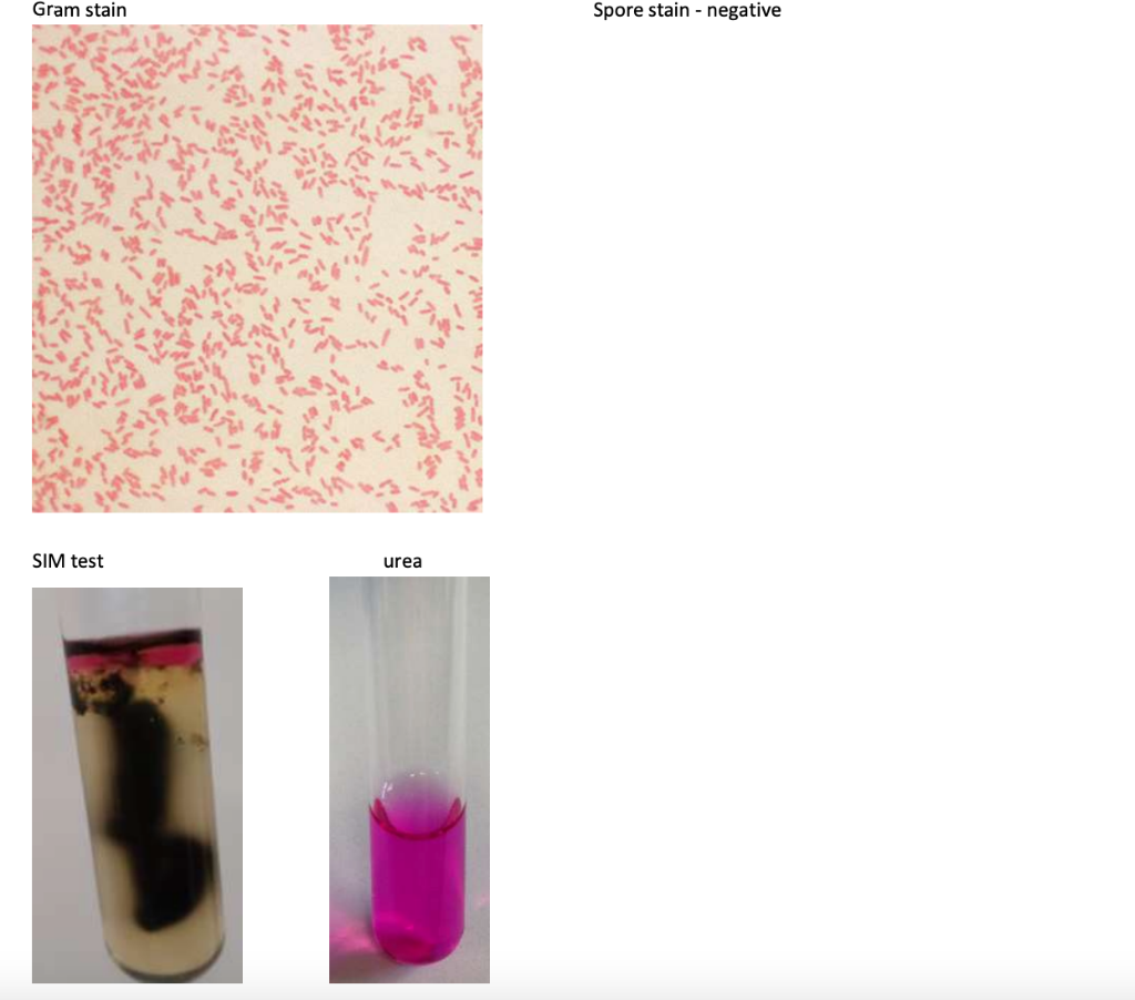 Solved SIM test Glucose TSI MacConkey plate ( growth) EMB | Chegg.com