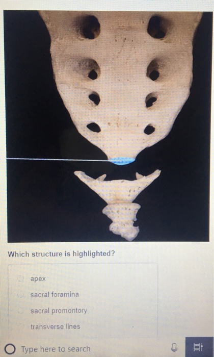 Solved Which structure is highlighted? apex sacral foramina | Chegg.com