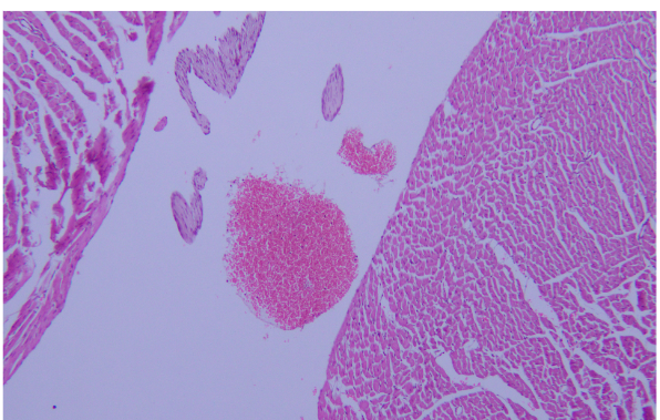 Solved This is 10X mag of a rats heart on a slide please | Chegg.com