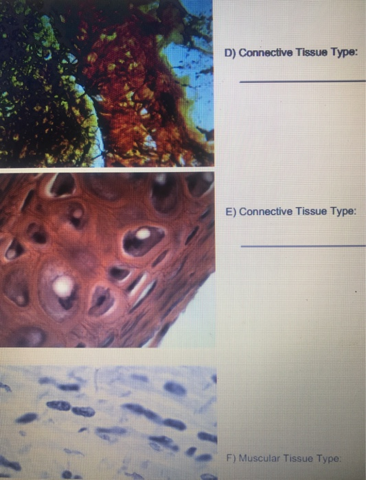 Solved H- Click here to enter text. A) Epithelial Tissue | Chegg.com