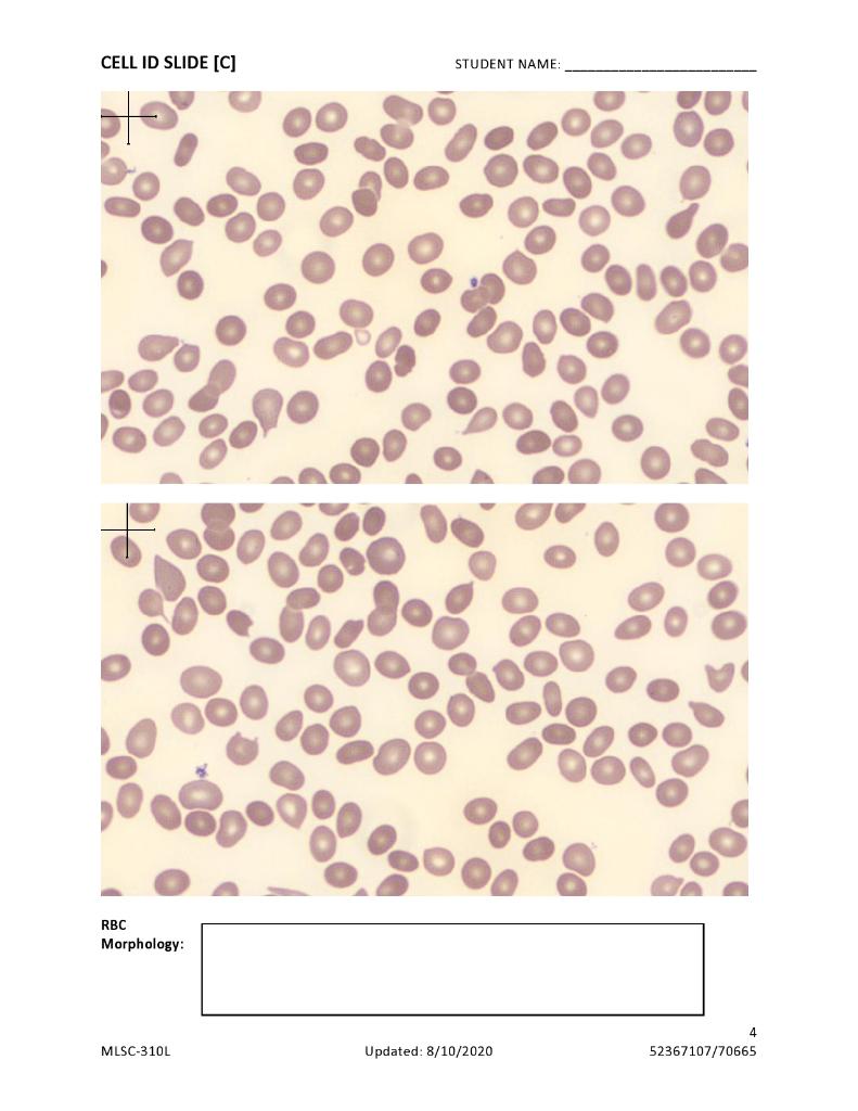 Solved CELL ID SLIDE [C] STUDENT NAME: WBC Differential: | Chegg.com