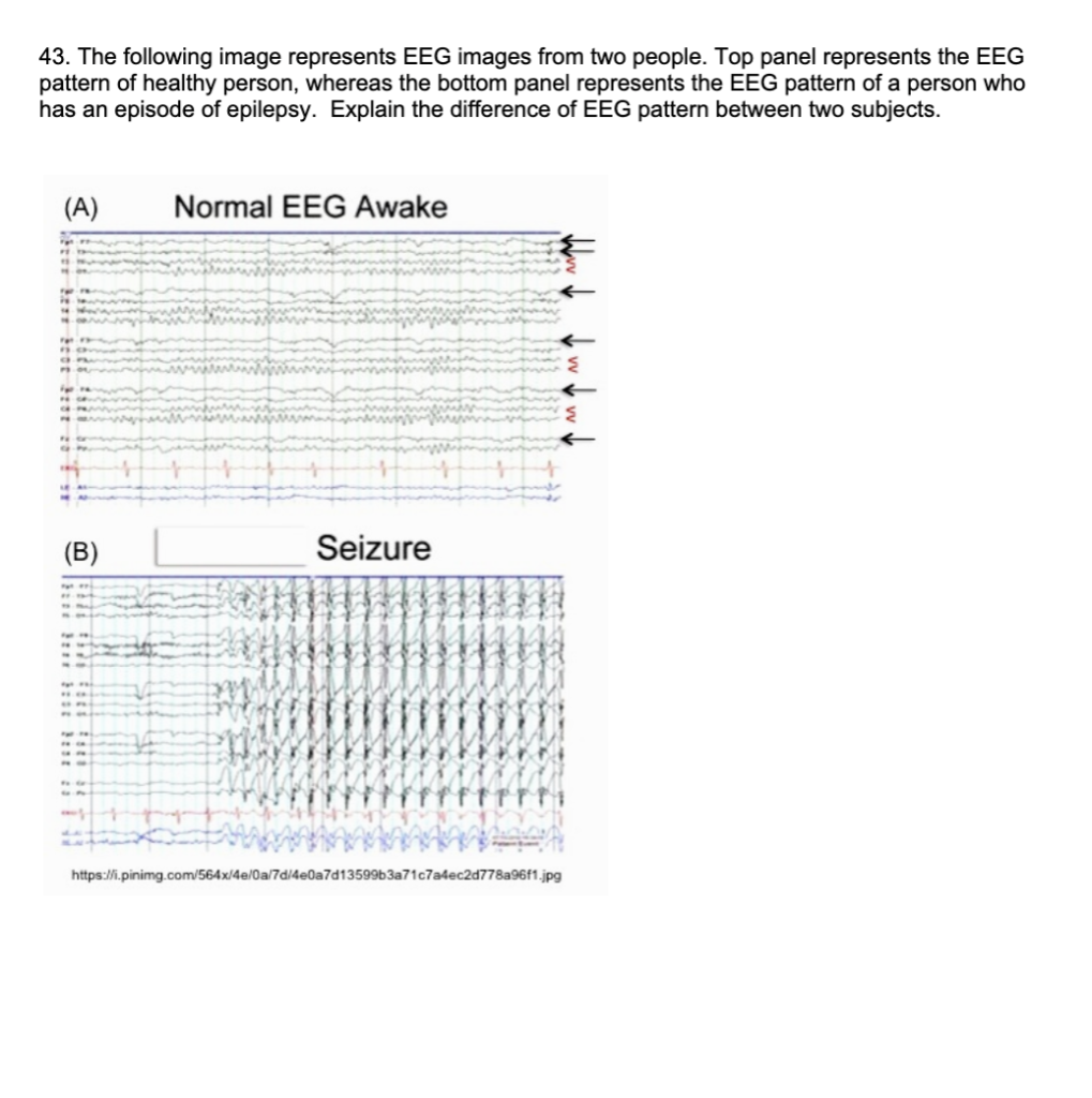 Solved 43. The following image represents EEG images from | Chegg.com
