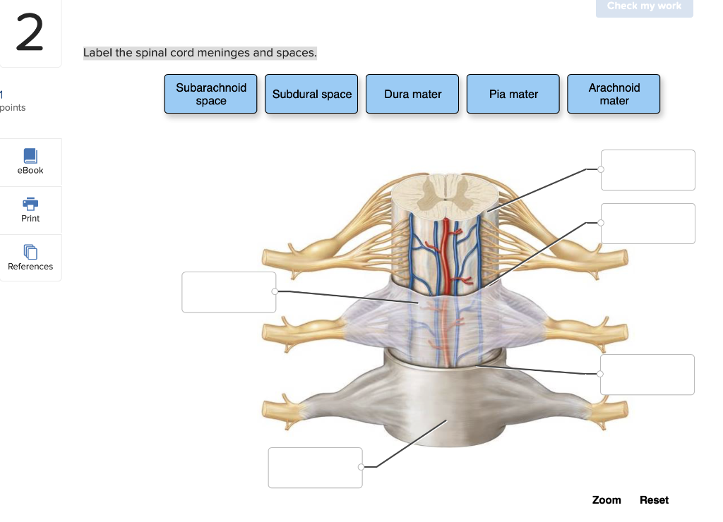 Solved Check my work 2 Label the spinal cord meninges and | Chegg.com