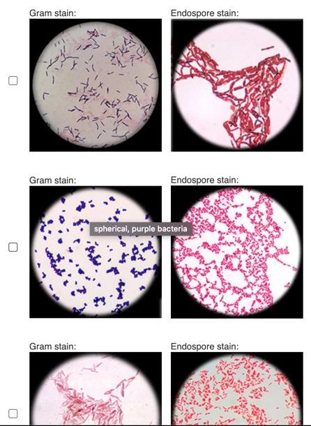 Solved Bacillus anthracis, like other Bacillus species, | Chegg.com