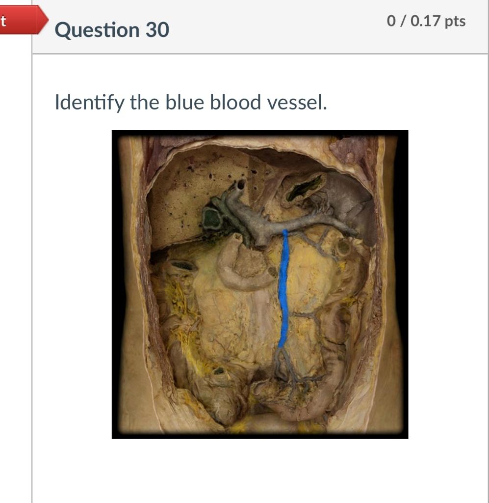 Solved Identify the blue blood vessel. Identify the blue | Chegg.com
