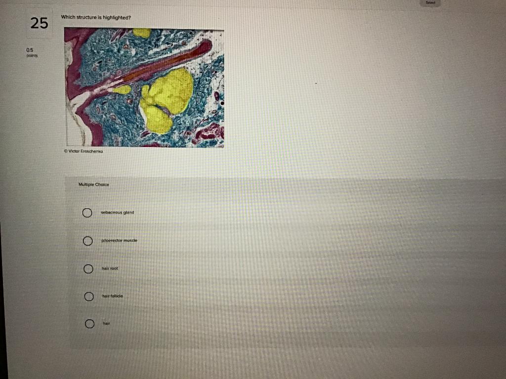Solved Which structure is highlighted? 25 0.5 points Victor | Chegg.com