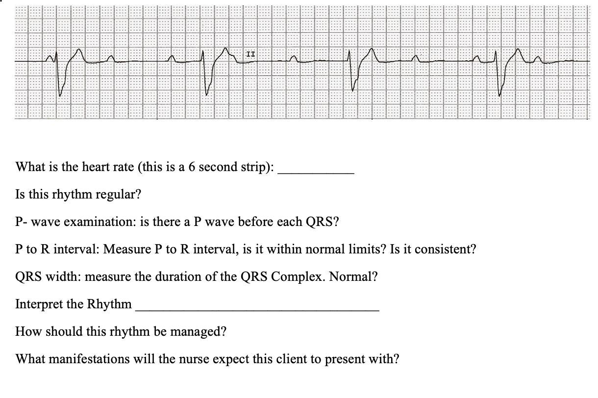 Solved What is the heart rate (this is a 6 ﻿second strip):Is | Chegg.com