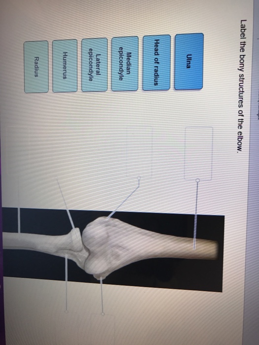 Solved Label the bony structures of the elbow. Ulna Head of | Chegg.com