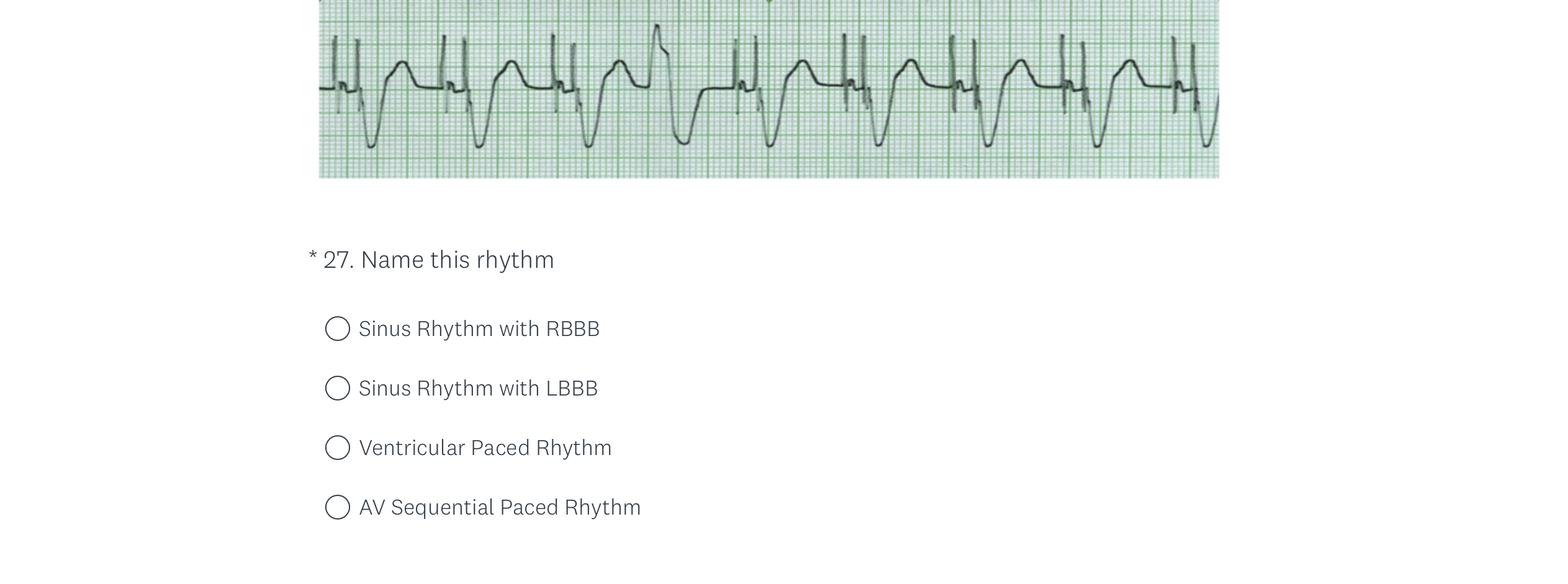 Solved Use the EKG strips to answer the questions below each | Chegg.com