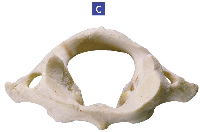 Solved Identify each of the following vertebrae in Figure | Chegg.com Solved Identify each of the following vertebrae in Figure | Chegg.com