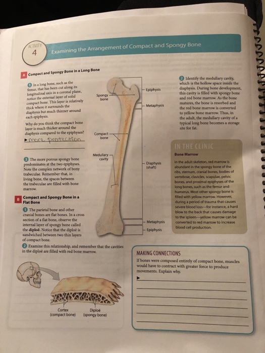 Solved Classifying Bones According to Location Bones can be | Chegg.com