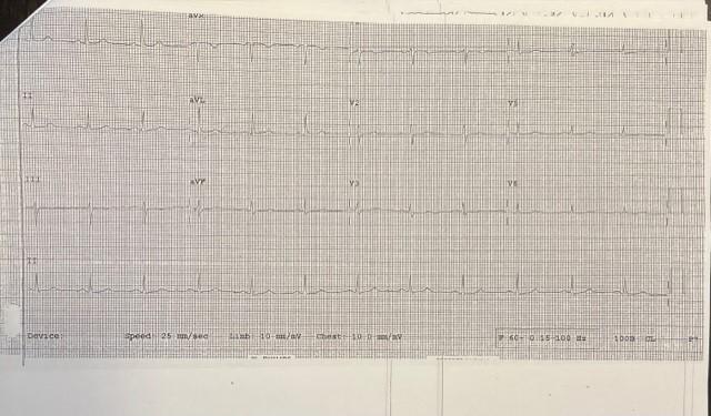 Solved Interpret the ECG | Chegg.com