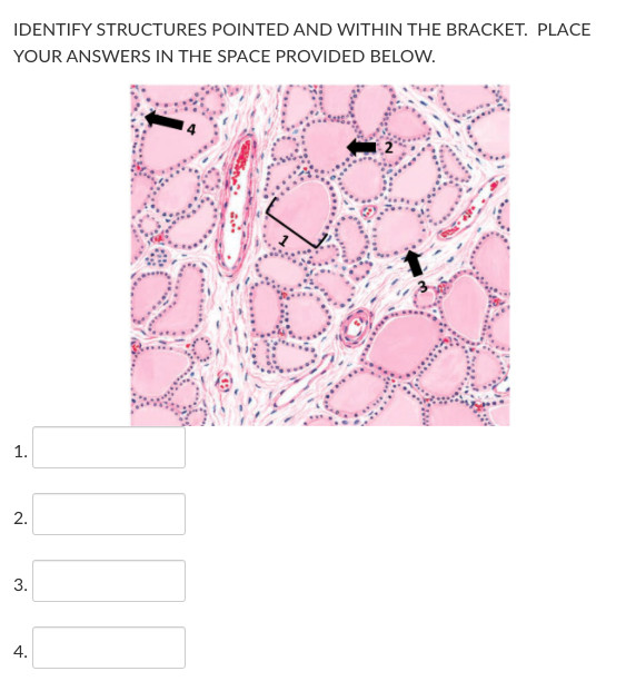 Solved IDENTIFY STRUCTURES POINTED AND WITHIN THE BRACKET. | Chegg.com
