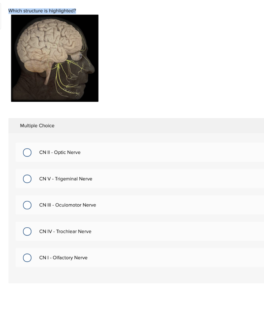 Solved Which structure is highlighted? Multiple Choice CN II | Chegg.com