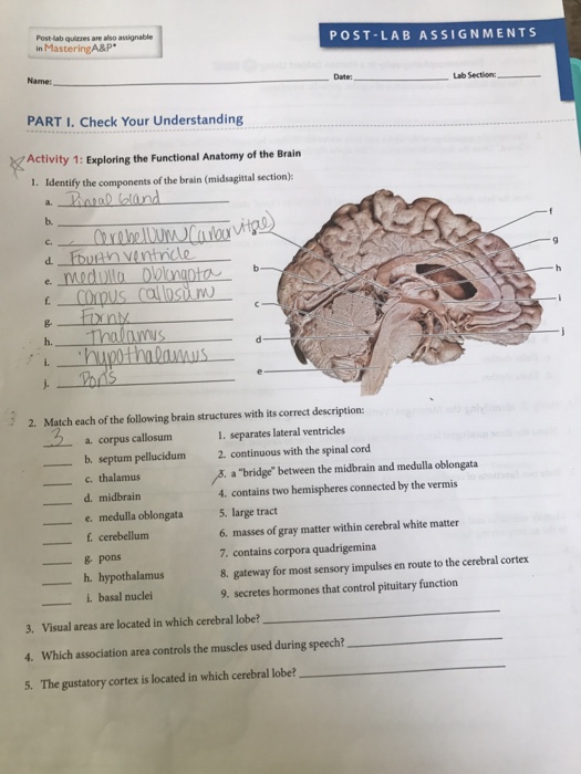 Solved: Identify The Components Of The Brain (midsagittal ... | Chegg.com