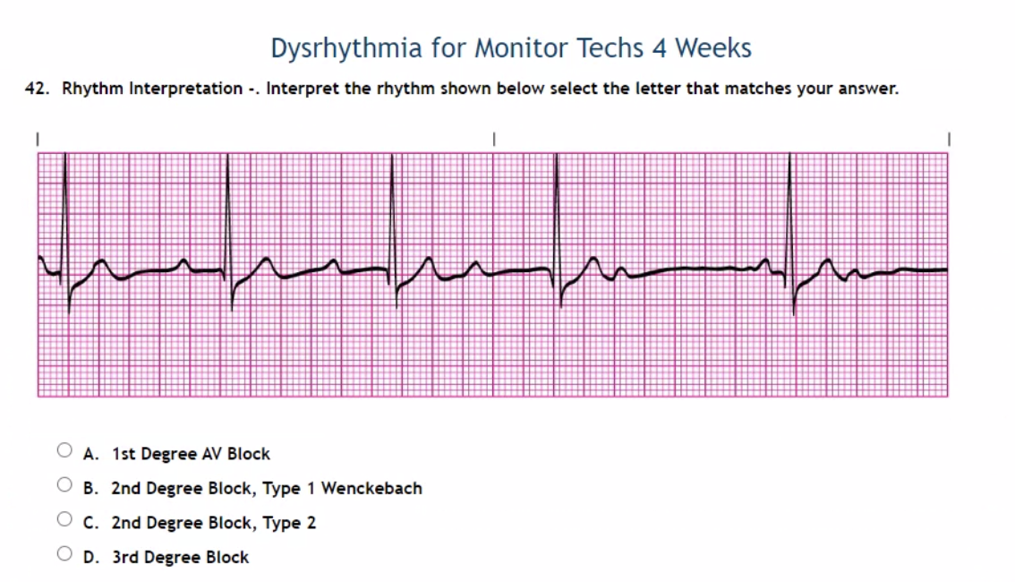 Solved Dysrhythmia for Monitor Techs 4 Weeks 42. Rhythm | Chegg.com