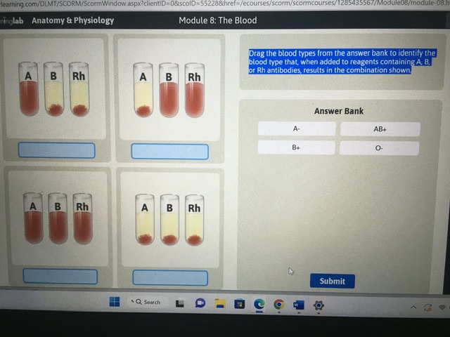 Drag the blood types from the answer bank to identify | Chegg.com